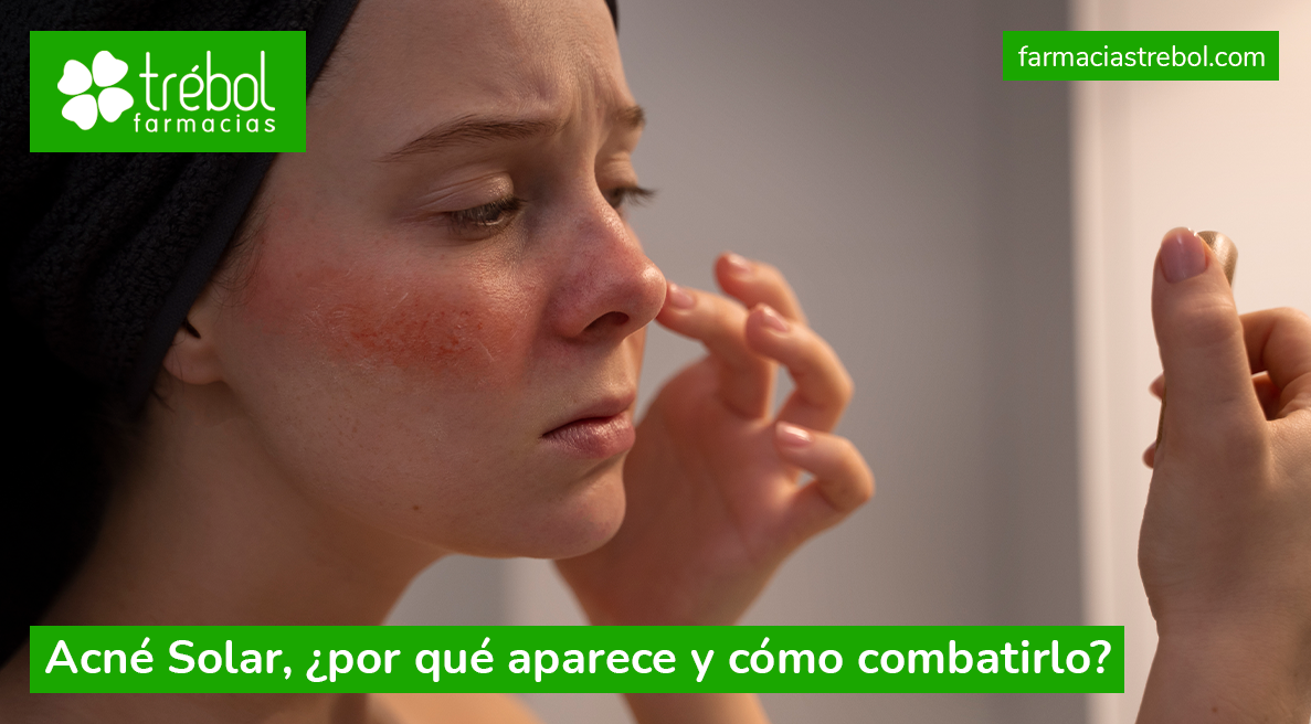 ¿Qué es el acné solar? | Farmacias Trébol